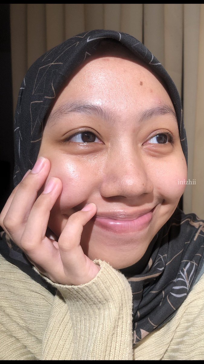 Chan on Twitter: "RT @inizhii: Kalo kamu sering nimbul redness / iritasi, coba deh pake toner yg ...