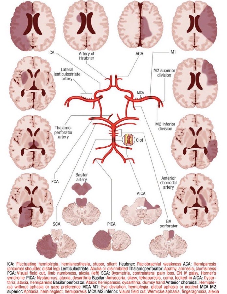 Circle Of Willis Lateral