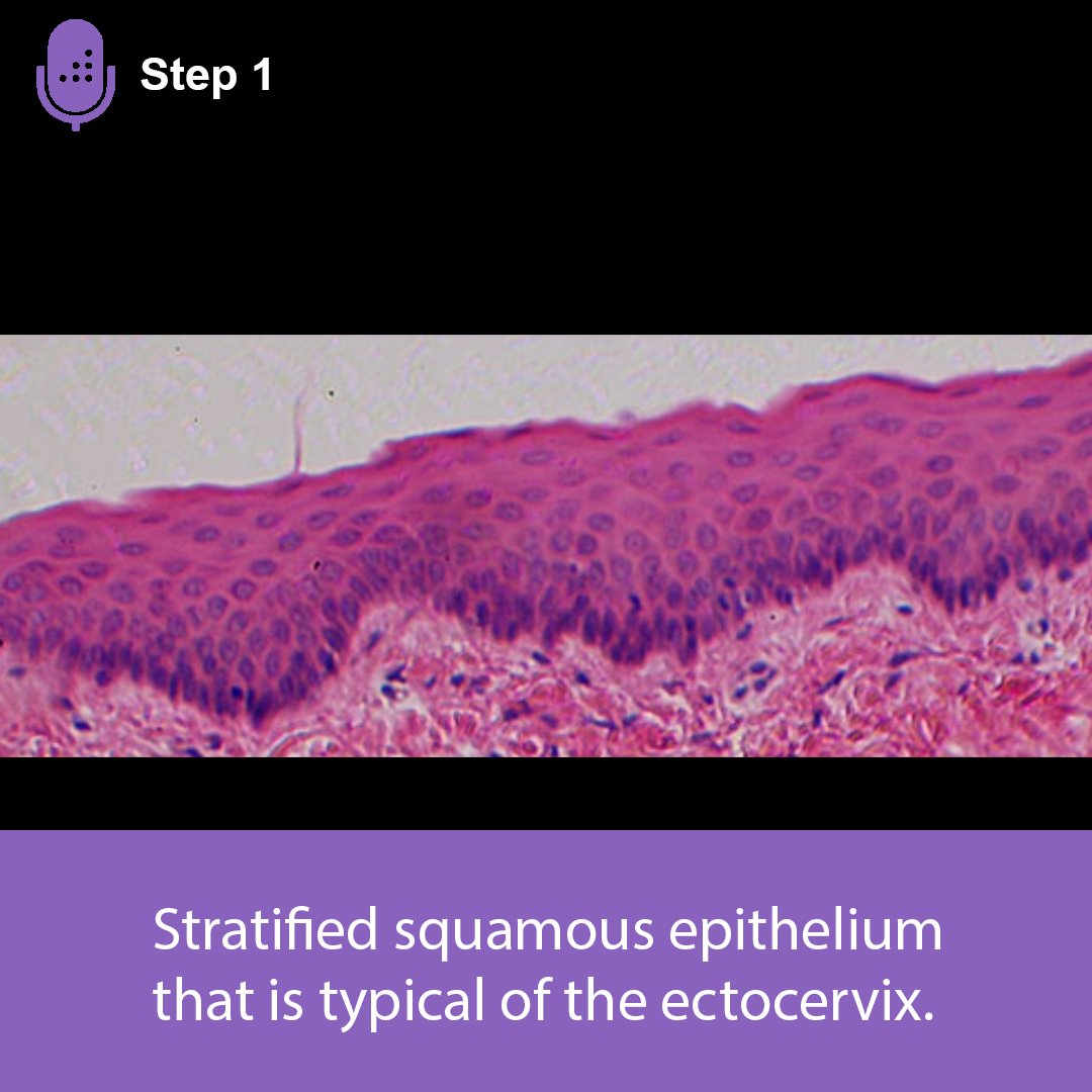 Stratified Columnar Epithelium