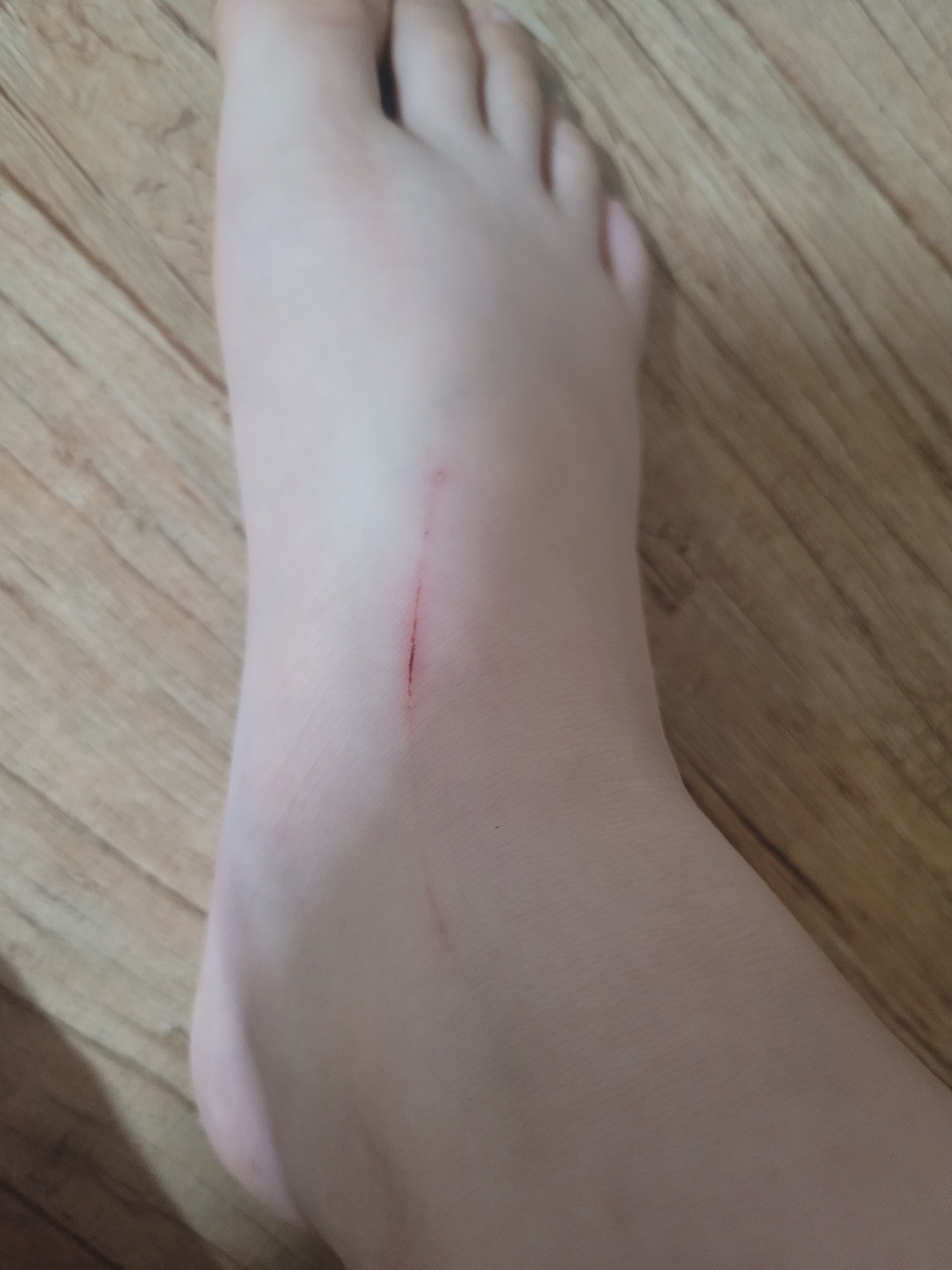 선지 (@tlqkf_bokjalove) / Twitter