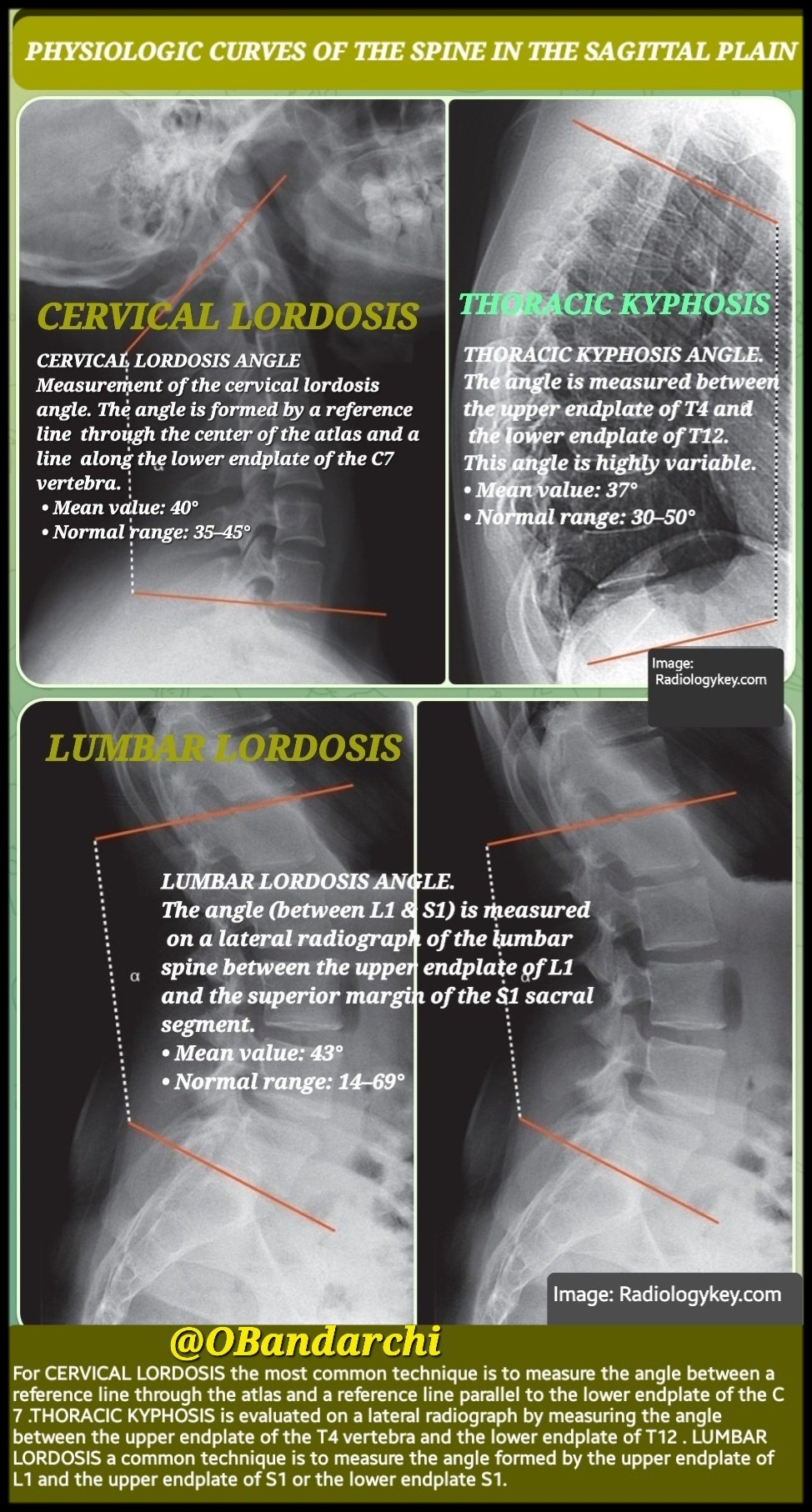 Thoracic Kyphosis Measurement