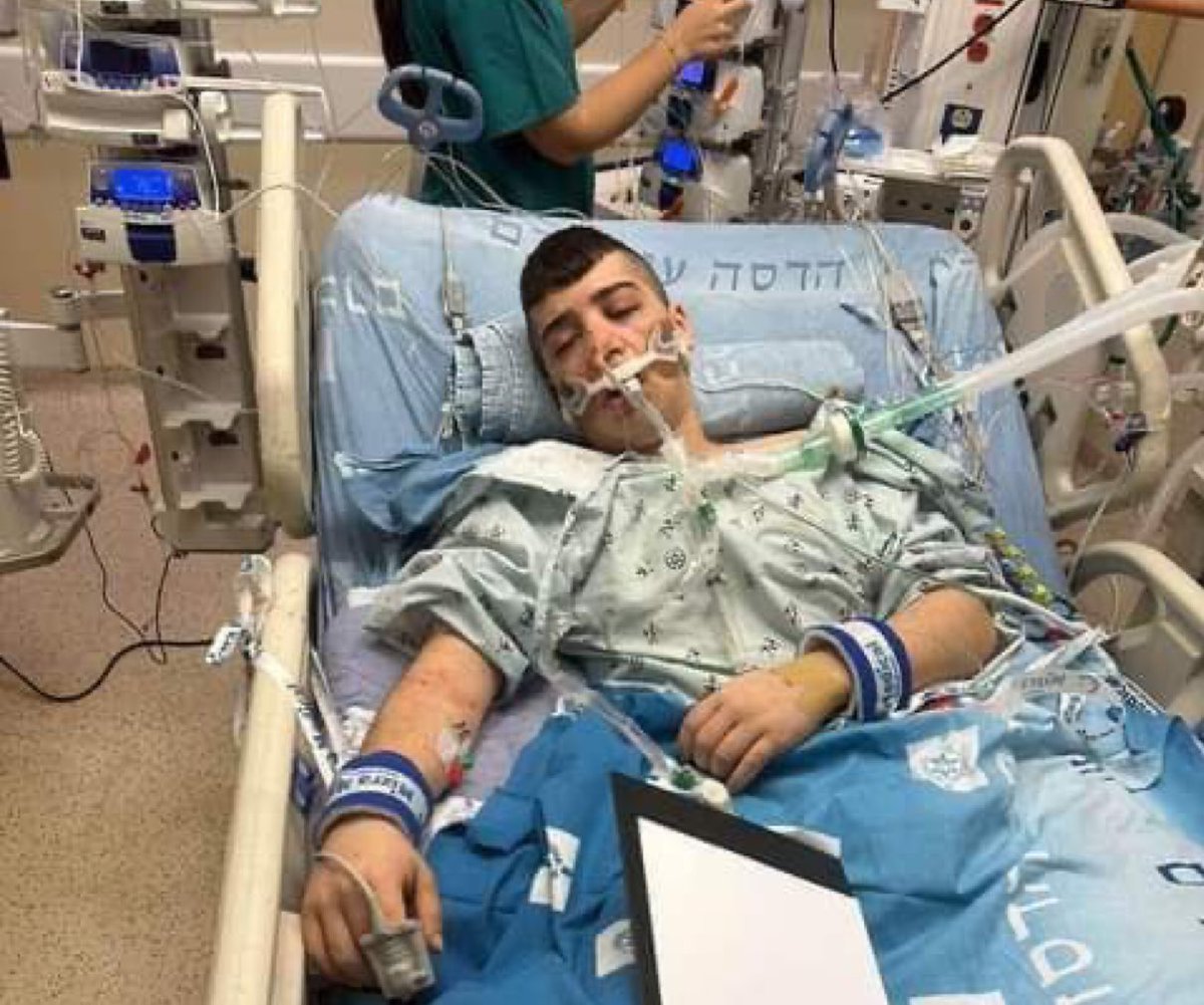 JayneH on Twitter: "RT @swilkinsonbc: Palestinian boy critical after being shot by israeli ...