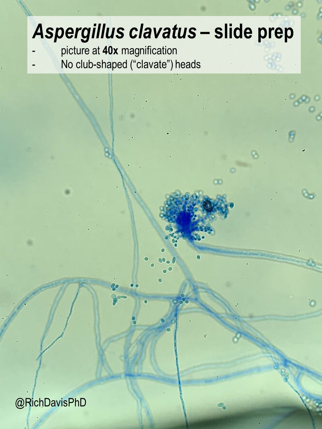 Aspergillus Conidia Slide
