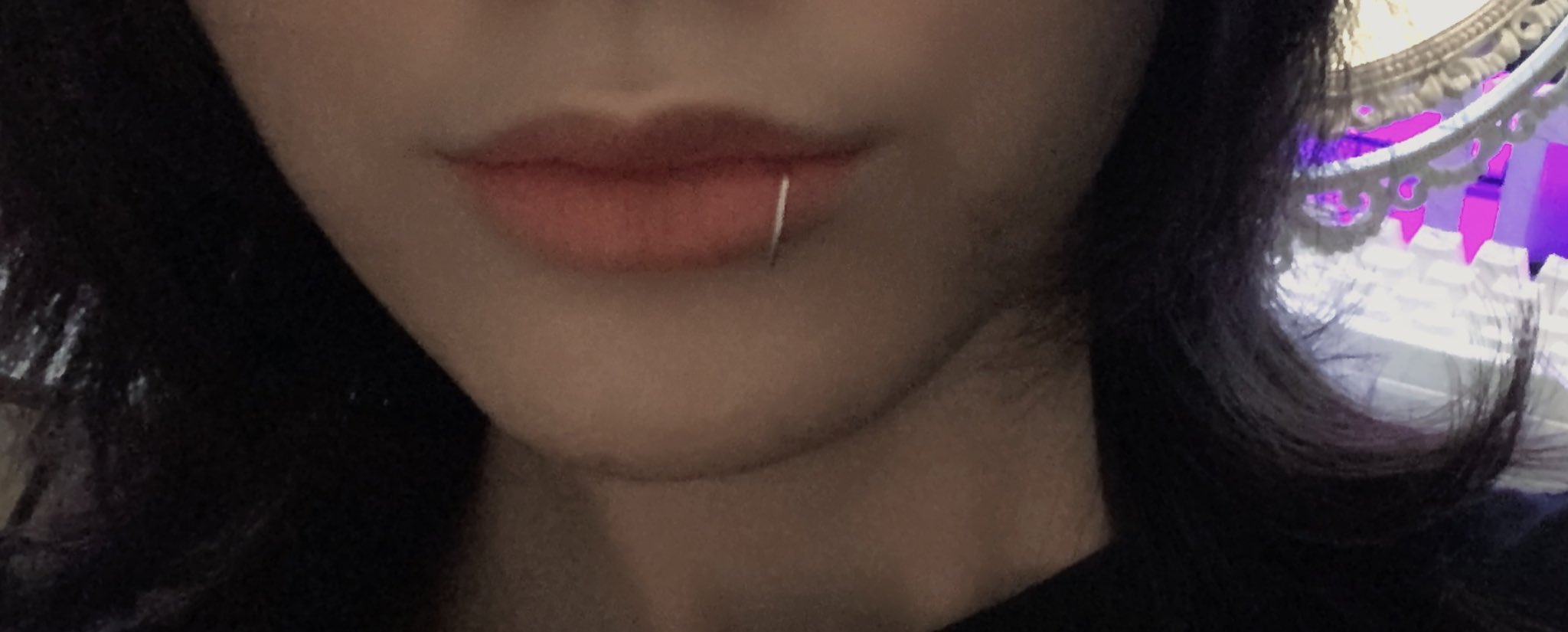 Medusa Piercing Scar