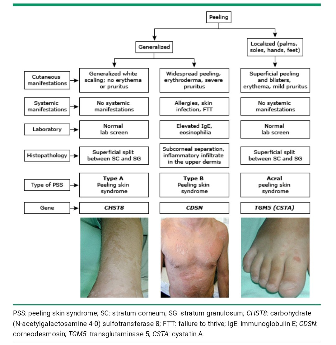 Sindrome Da Pele Descascada Acral Melanoma | Concise Medical Knowledge