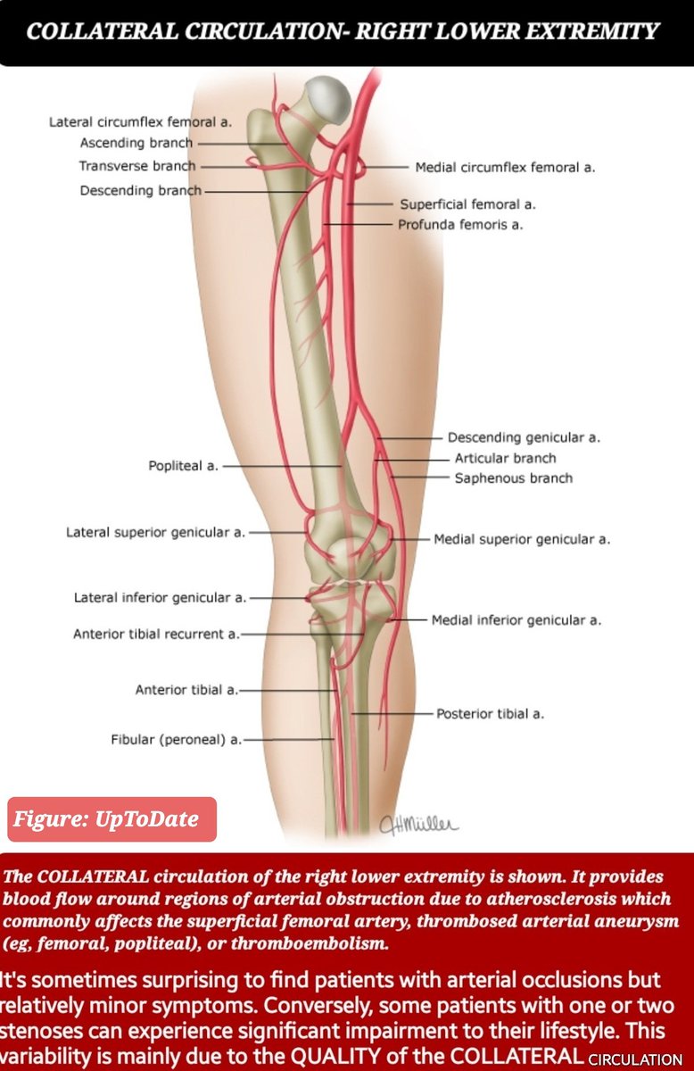 Collateral Circulation Lower Extremity