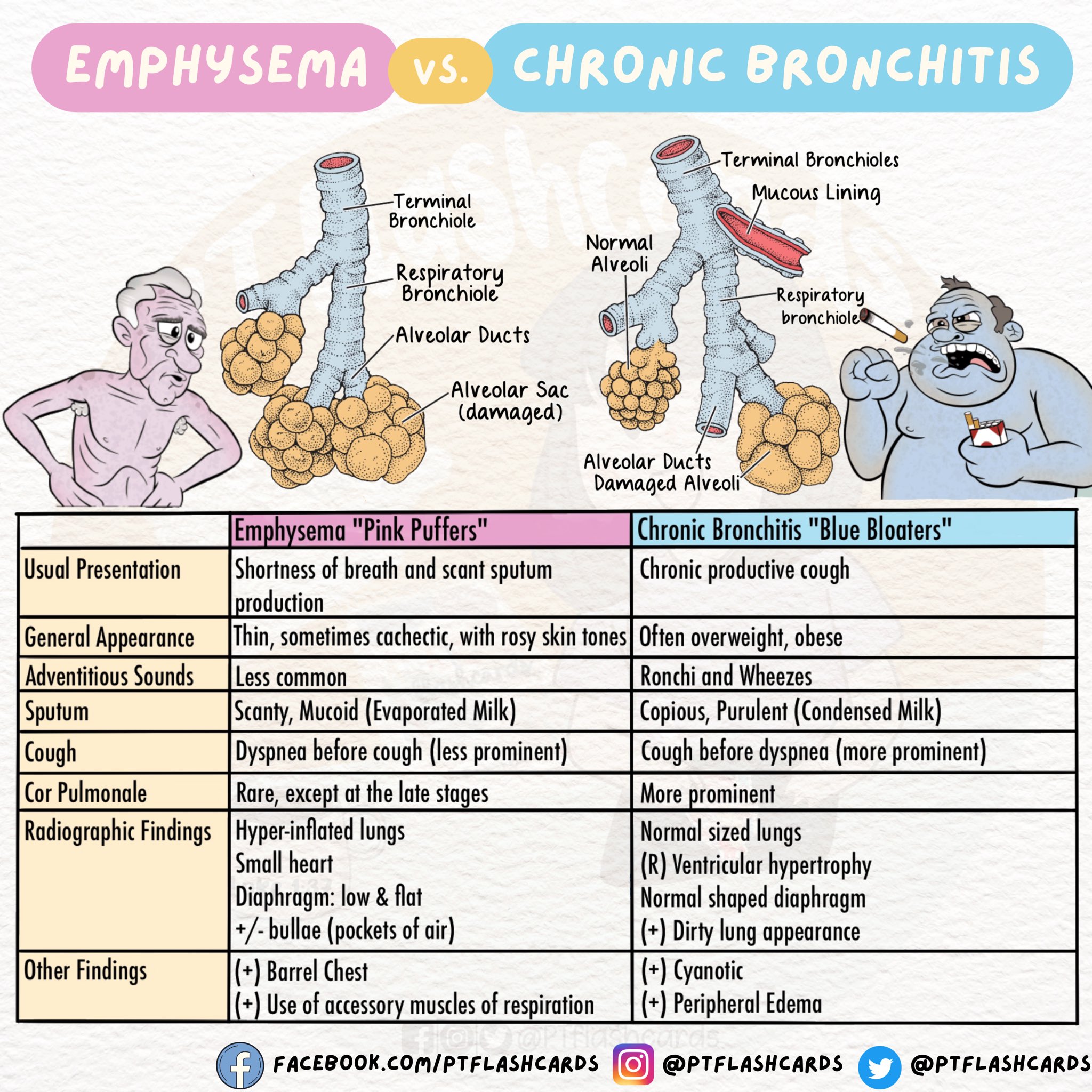 Barrel Chest Copd Emphysema