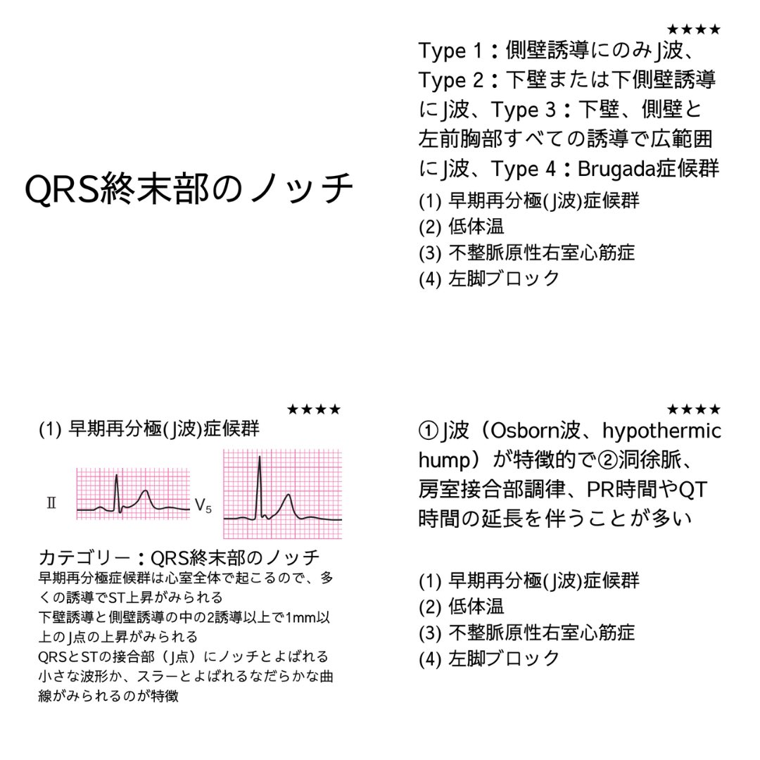 心電図くま on Twitter: "あなたの心電図語彙力をぶち上げる、心電図エクスプレス～QRS終末部のノッチ編～をまとめました。"