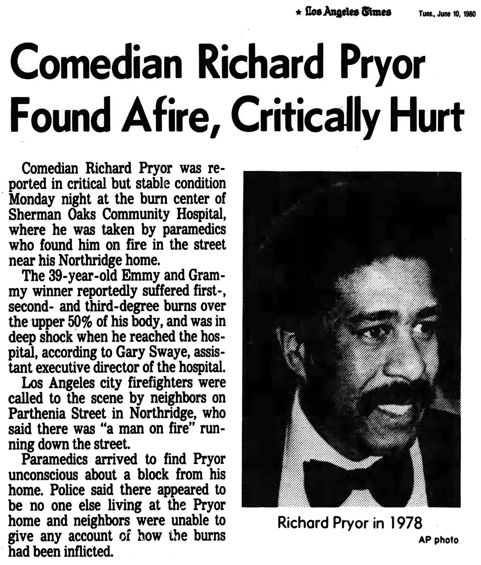 Richard Pryor Burned Face
