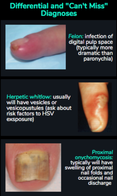 Staphylococcal Whitlow