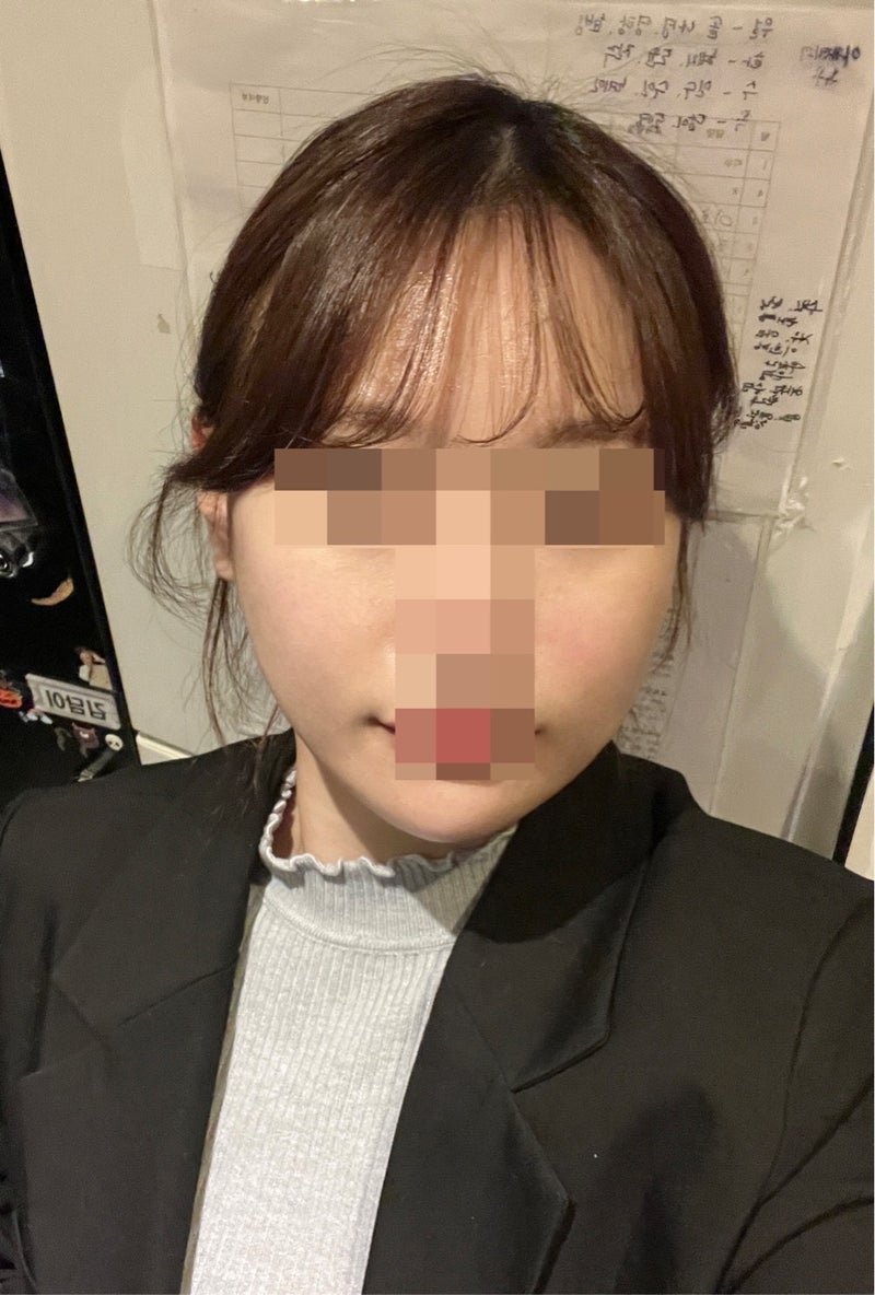 ナビコリア🍀 韓国美容整形🇰🇷 エージェンシー 2008年から~ on Twitter: "輪郭専門SODA美容外科で手術された方たちのリアルレビュー🥰 👉https://vo.la ...