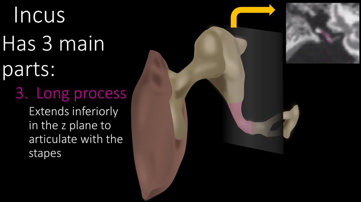 1/ “Now listen carefully!” Does the word “tbone” make you think of a ...