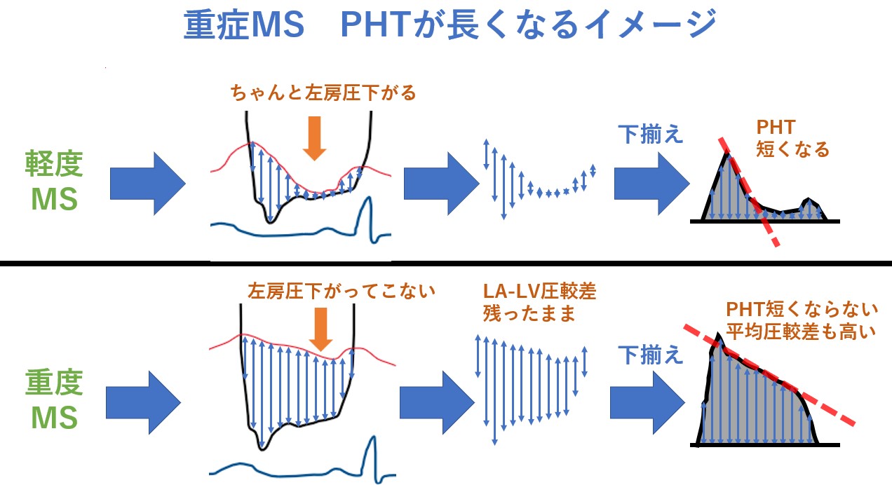 miyahara/心エコー技師 on Twitter: "こっちはMS-PHTです。 https://t.co/o1mH73RceL" / Twitter