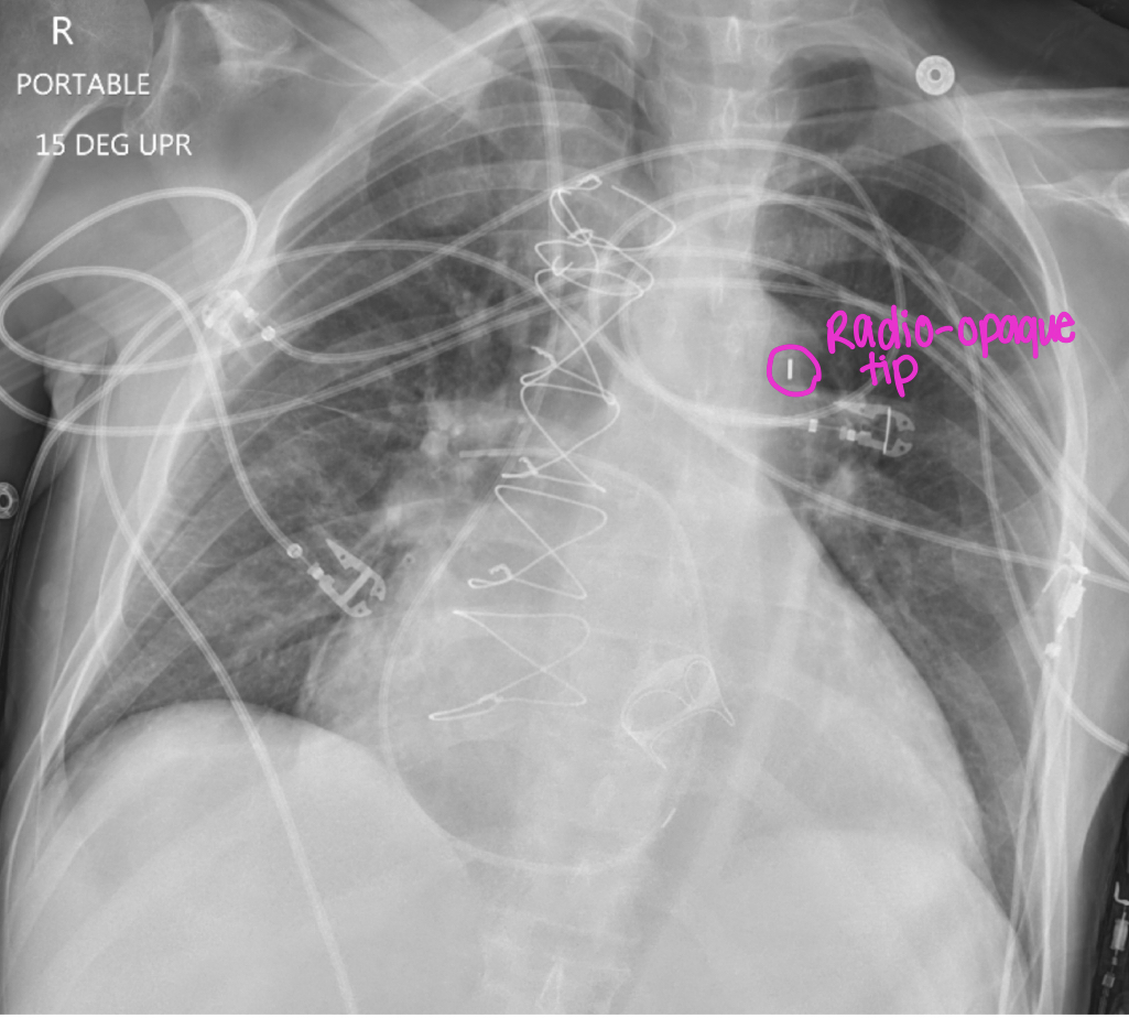 1 28 You Are The Resident On Cicu A Patient Arrives With An Intra