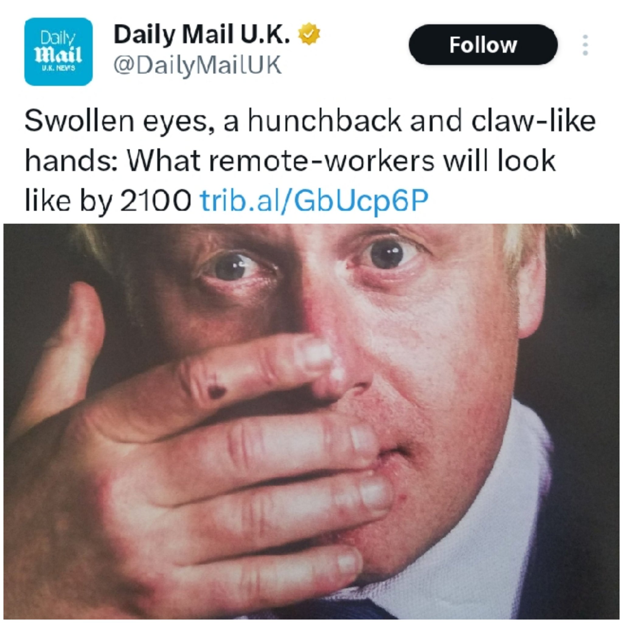 Swollen Eyes Memes The Funny Side To Chronic Health. Spoiler Alert,