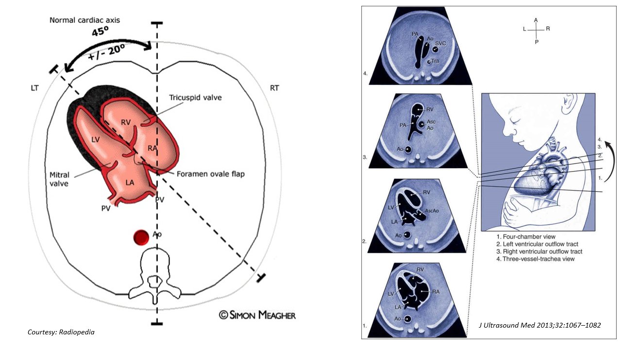 Fetal Heart
