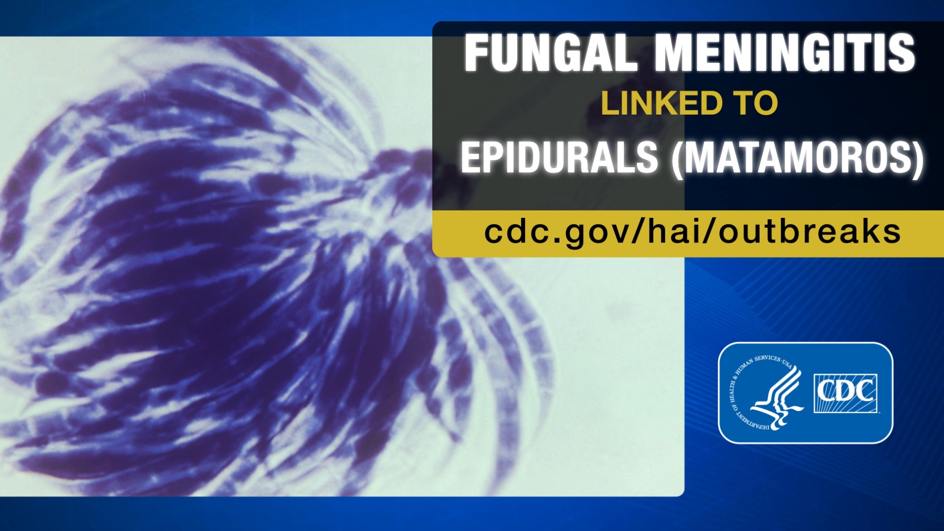 Fungal Meningitis
