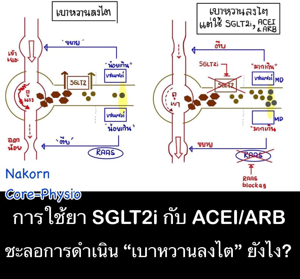 Nakorn-Core Physiology and Medical Science on Twitter: "📌📌 สำหรับบุคคลทั่วไป 📌📌 . . เบาหวานทำ ...