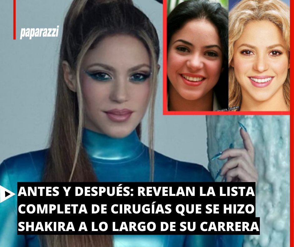 Shakira Antes Y Despues El Notable Cambio Físico De Shakira Antes Y