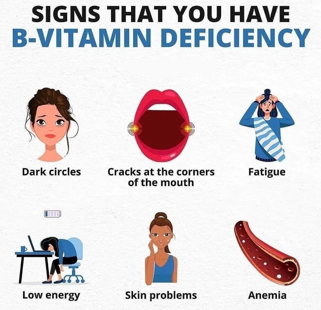Vitamin B Deficiency Symptoms Health Benefits Thiamine Diary Store
