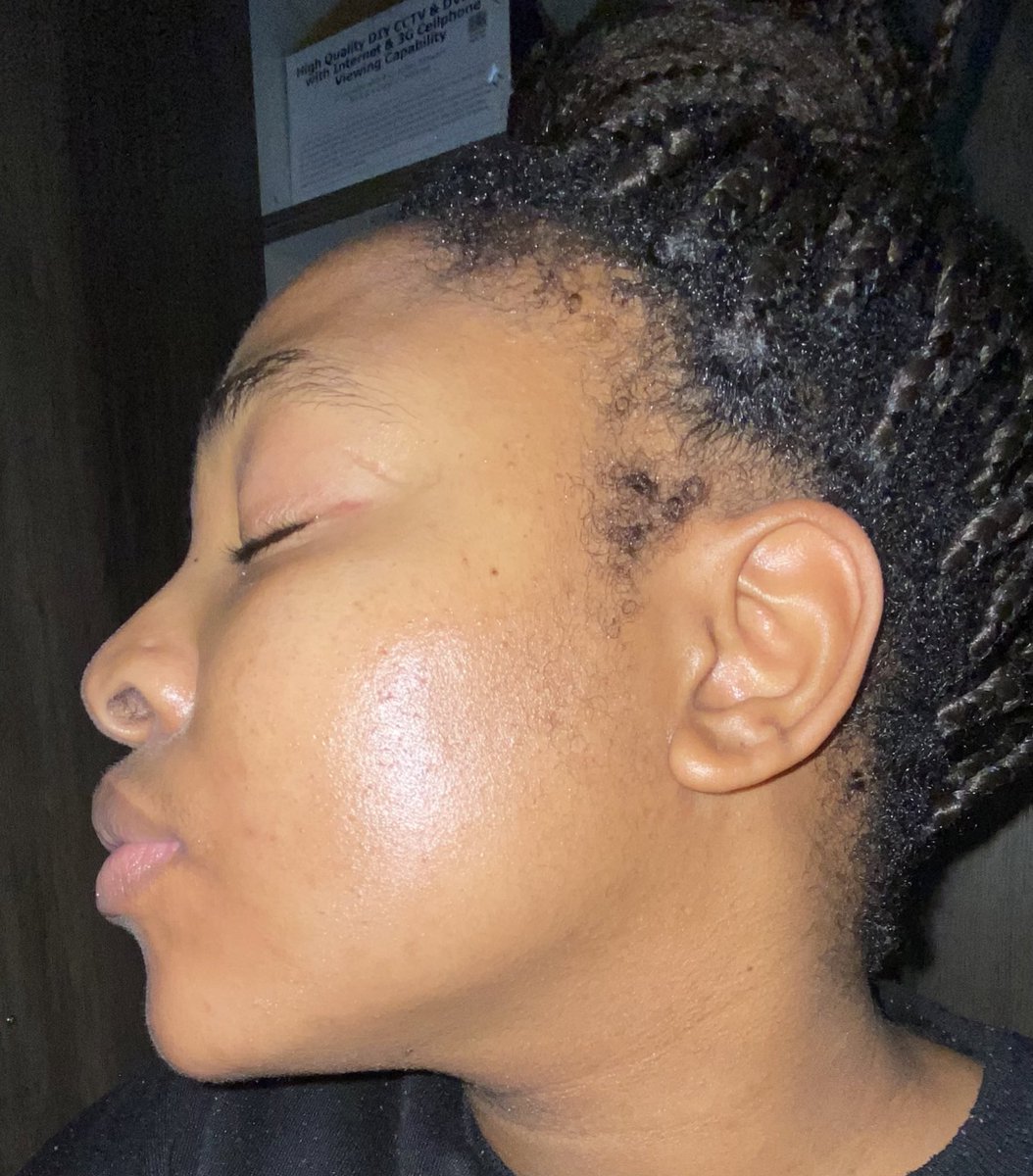 What a transformation 😭 everything else + retinol 🥺🔥 - Thread from Gugu ...