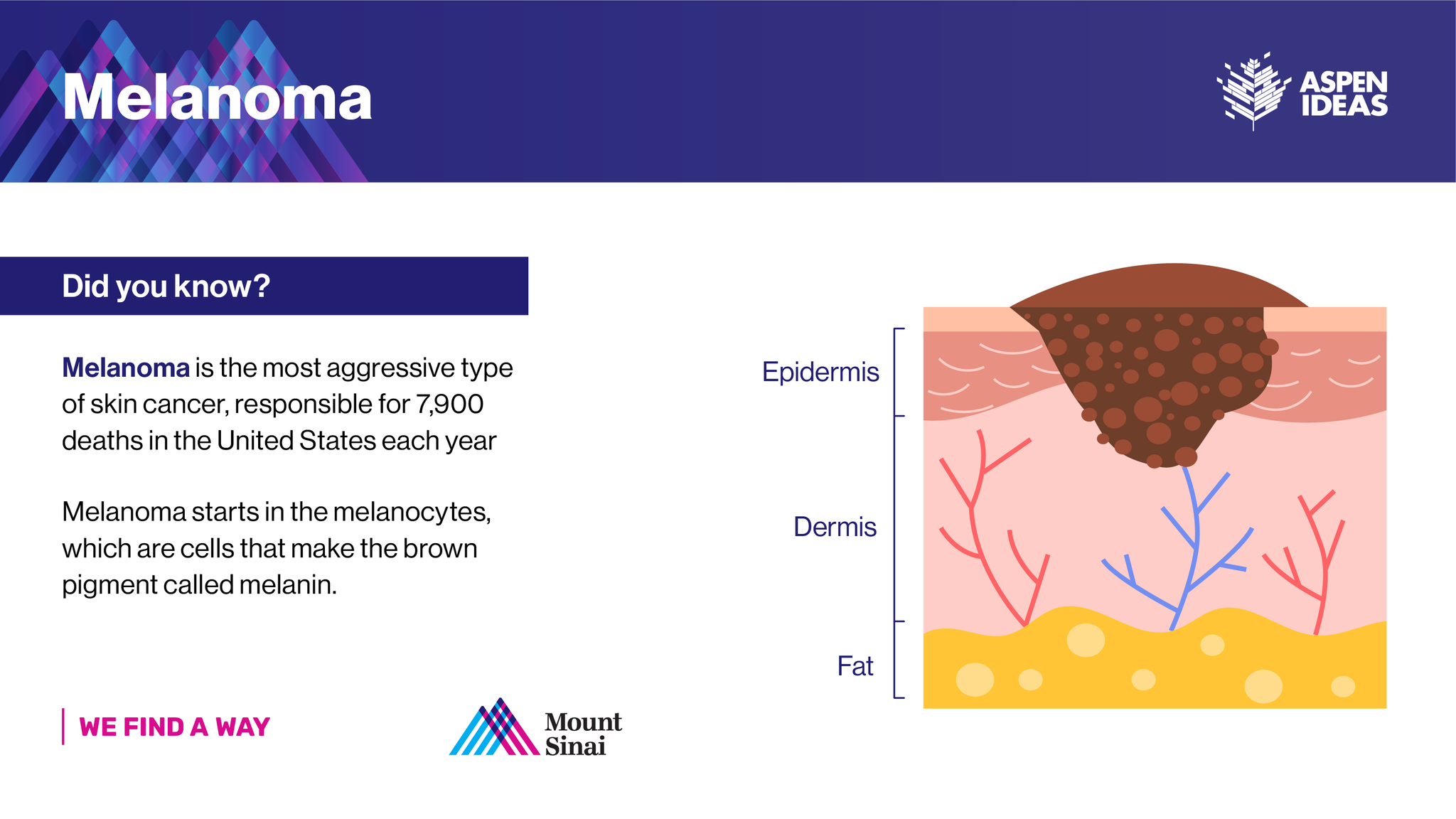 Types Of Skin Cancer Diagram