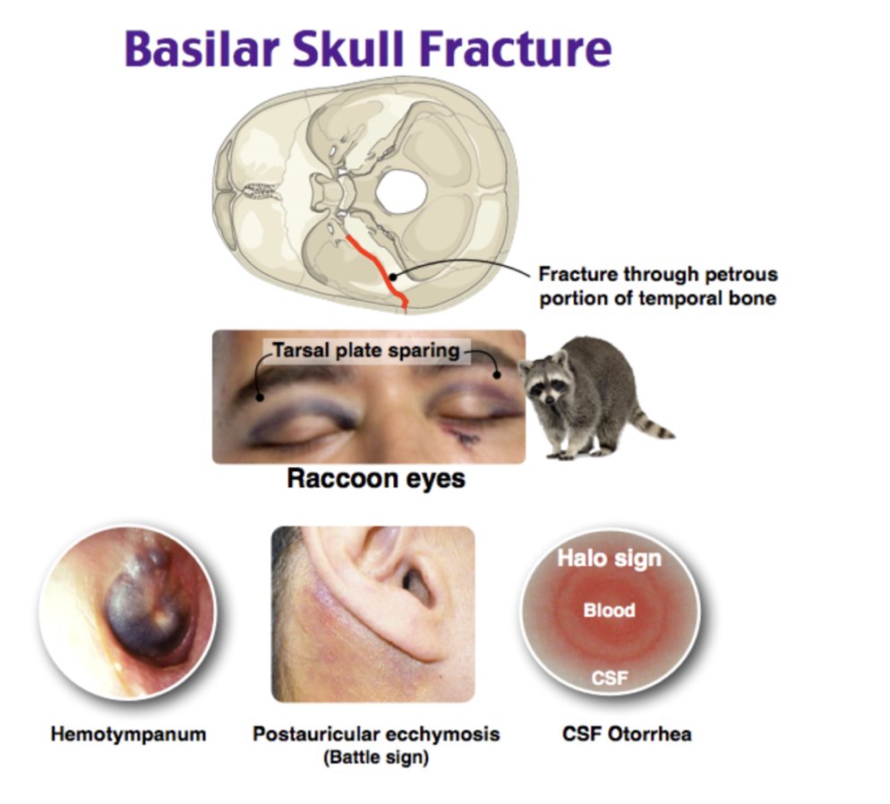 Surgery Shelf / Step 2 CK Cheat Sheet - Thread from Dr. Austin Price ...