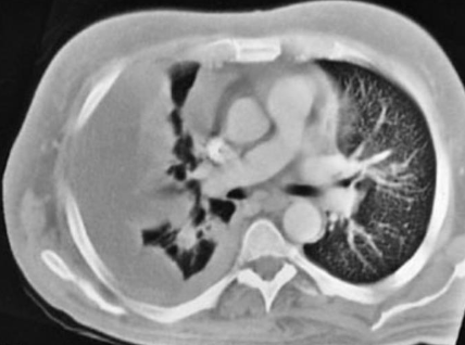 Surgery Shelf / Step 2 CK Cheat Sheet - Thread from Dr. Austin Price ...