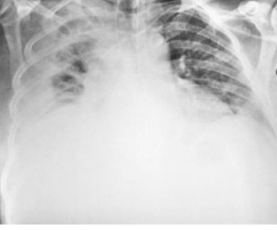 Surgery Shelf / Step 2 CK Cheat Sheet - Thread from Dr. Austin Price ...