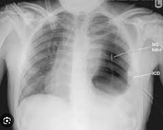 Surgery Shelf / Step 2 CK Cheat Sheet - Thread from Dr. Austin Price ...