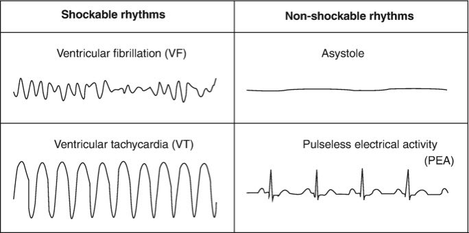 📢📢 انتباااااااه 📢📢📢 اليوم بإذن الله راح أتكلم عن موضوع مهم غالبًا يُدفع عليه مبالغ لكني بقدمه لك ...