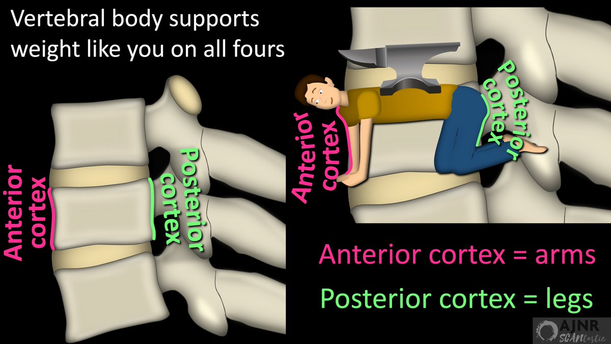 1/Reading spine studies with compression fractures is back-breaking ...