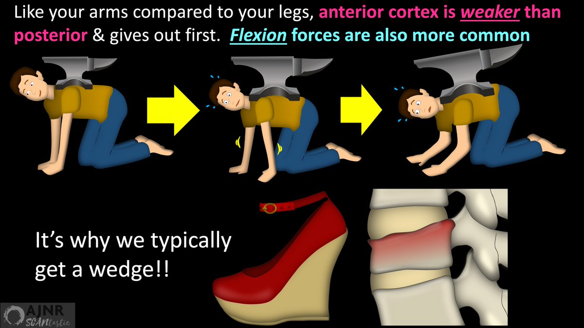 1/Reading spine studies with compression fractures is back-breaking ...