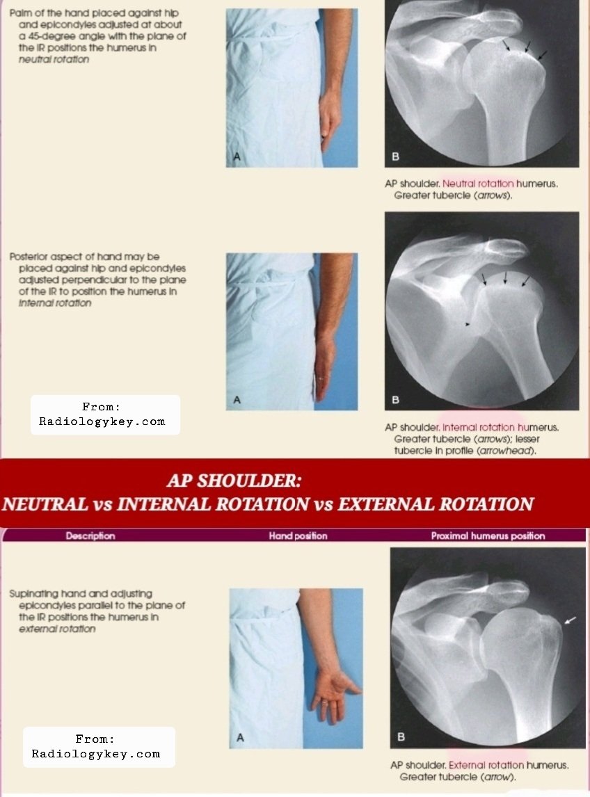 Shoulder Internal And External Rotation Effectiveness Of A Shoulder
