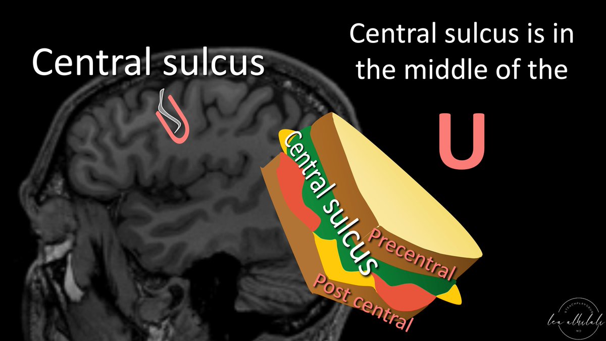 1/There’s nothing more CENTRAL to reading an MRI than finding the ...