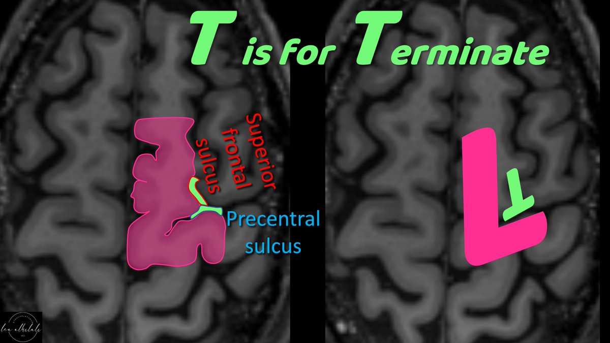 1/There’s nothing more CENTRAL to reading an MRI than finding the ...