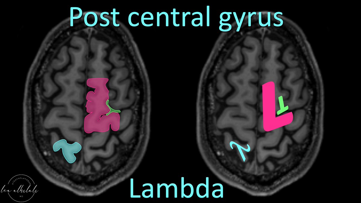 1/There’s nothing more CENTRAL to reading an MRI than finding the ...