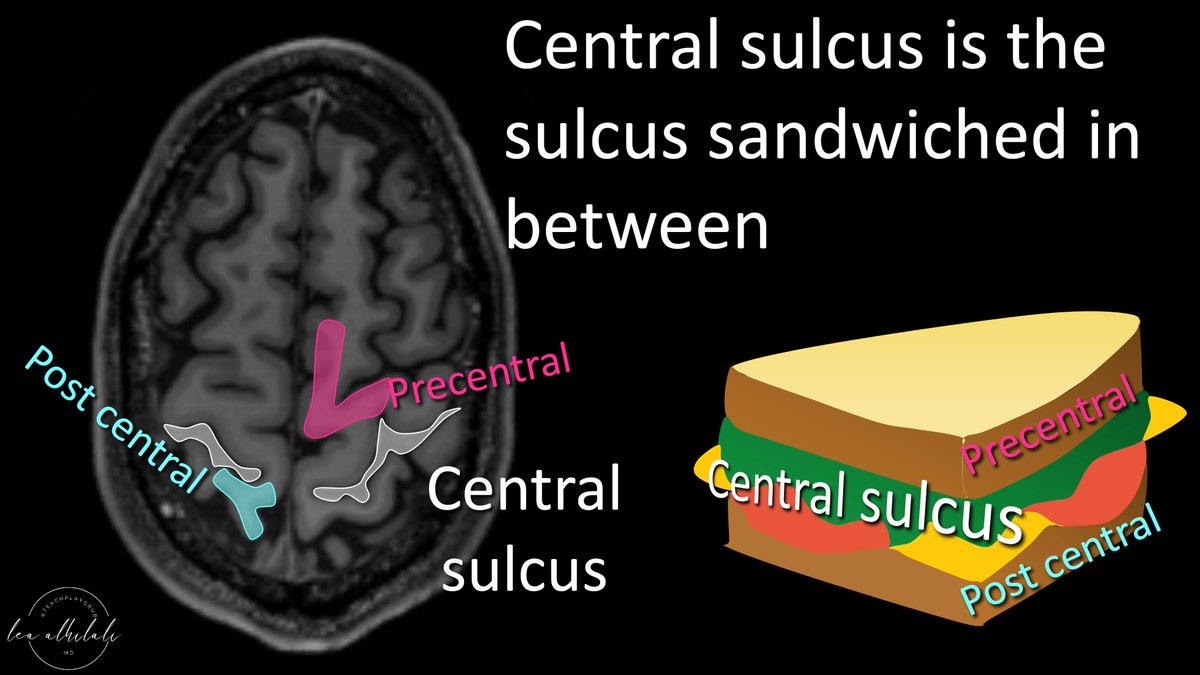 1/There’s nothing more CENTRAL to reading an MRI than finding the ...