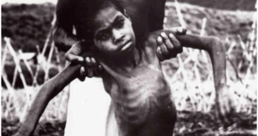 Kuru Victims Kuru A Journey Back In Time From Papua New Guinea To The