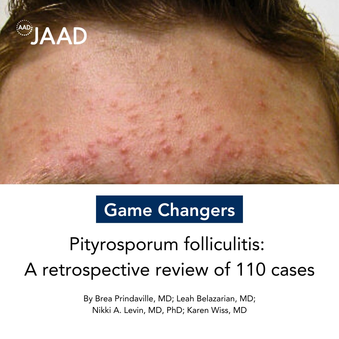 Perforating Folliculitis Face