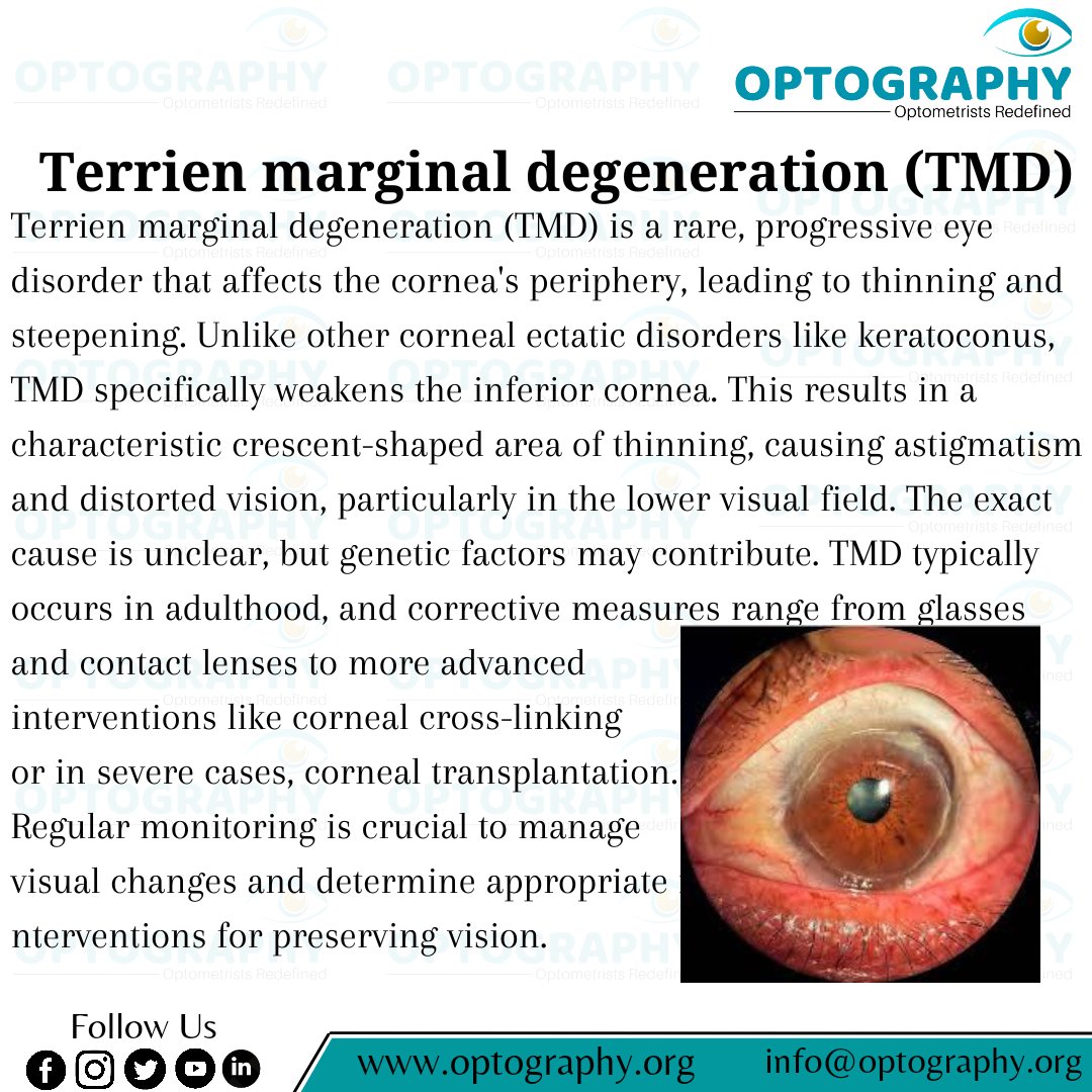 Optography @Optography8 - Twitter Profile | Sotwe