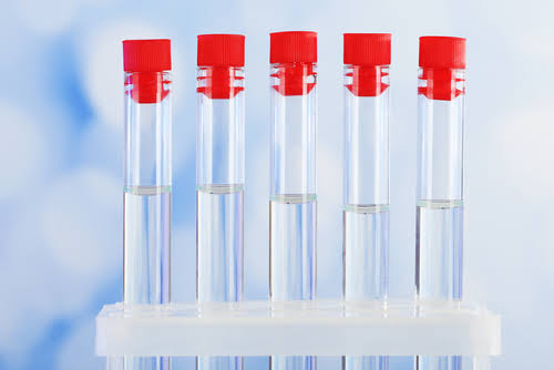 🧠 CSF HSV PCR is diagnostic of HSV encephalitis but may be negative if ...