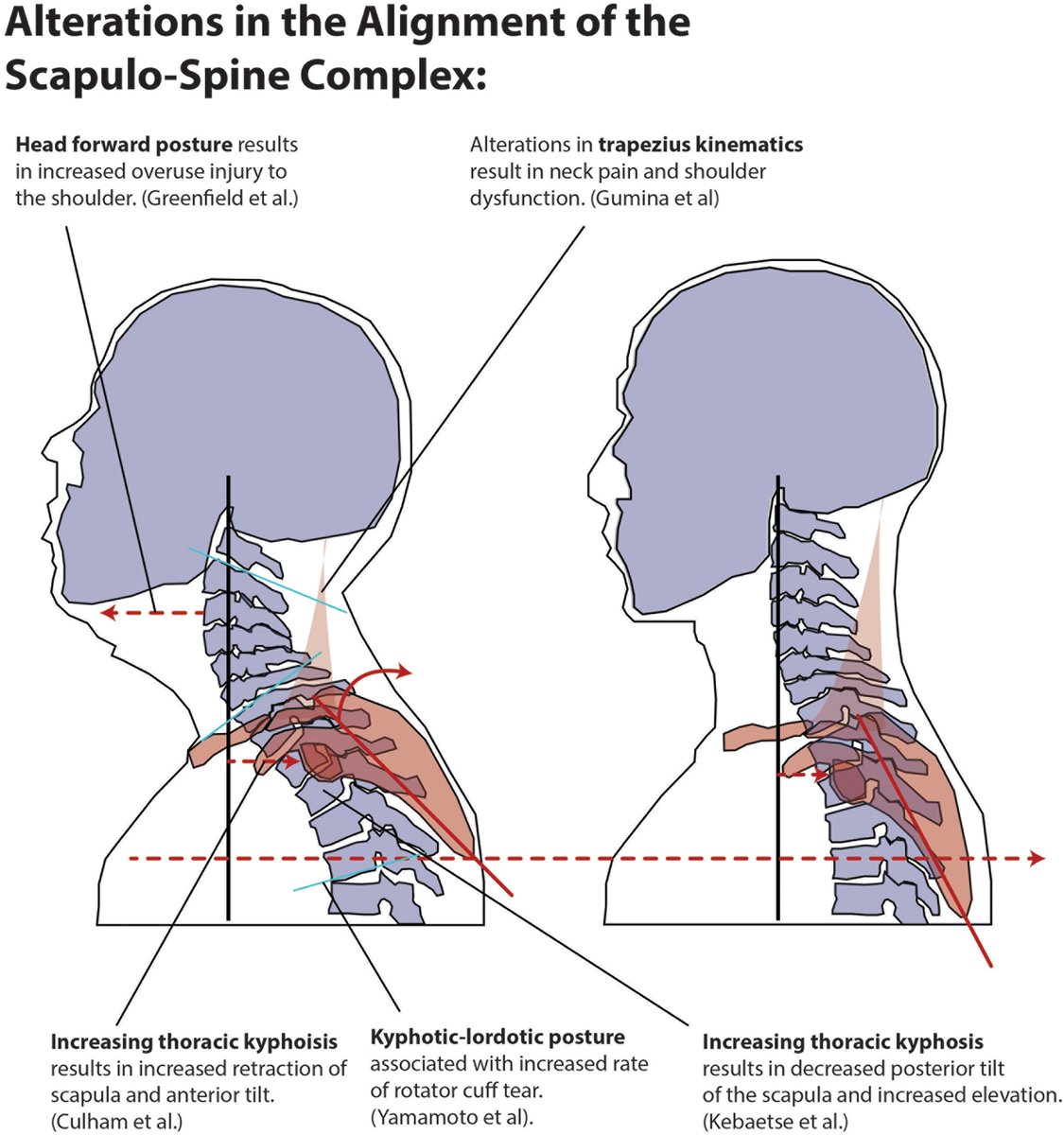Scapular Spine