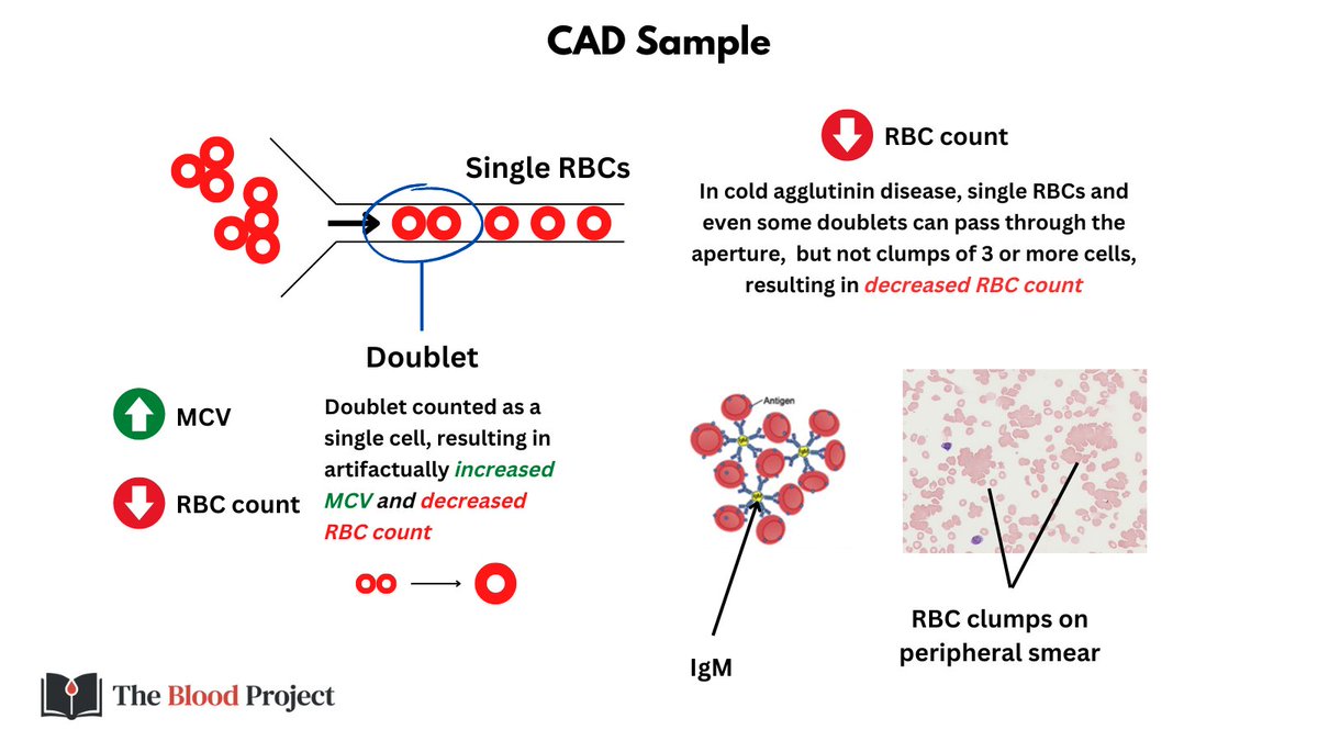 1/7 COLD AGGLUTIN DISEASE I tweeted an unknown CBC yesterday and asked ...