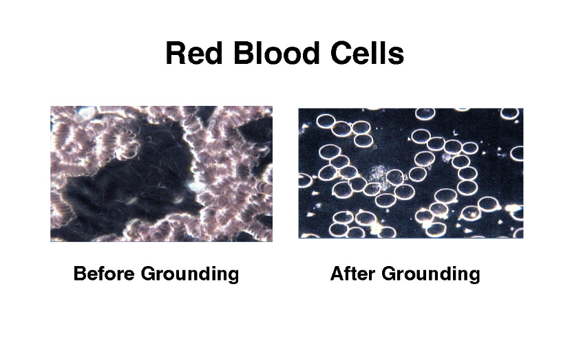Grounding has shown to decrease inflammation significantly. (mini ...