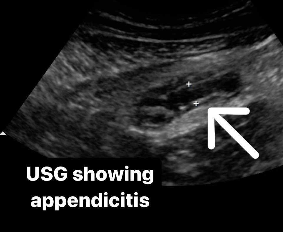 🚨 Thread: Radiology in Common Emergencies 🚨1/x #Medtwitter #radiology # ...