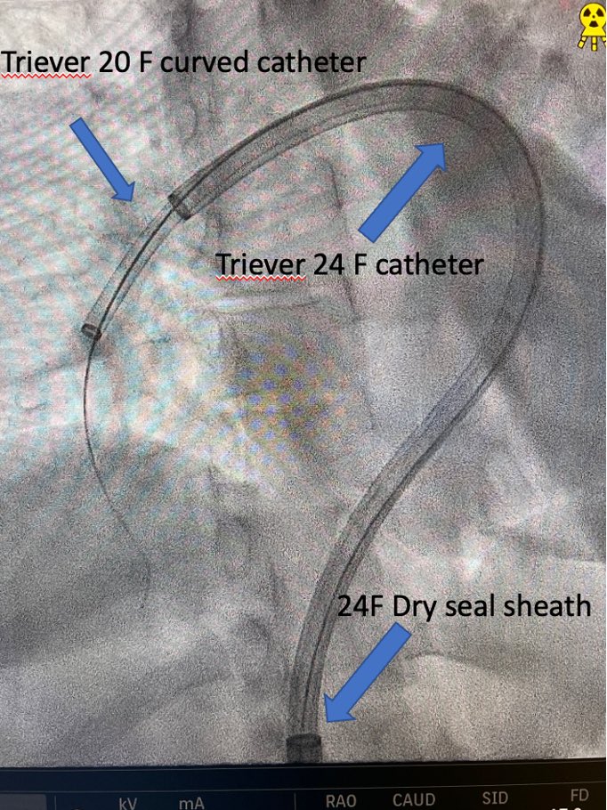 Thread by @MadhuraMyla on Thread Reader App – Thread Reader App