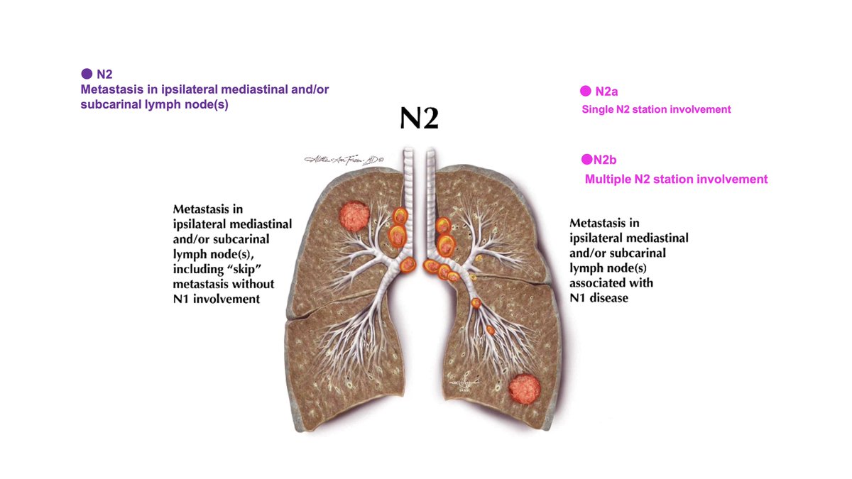 🌟 The 9th edition of TNM Classification for Lung Cancer 🫁 1, January ...