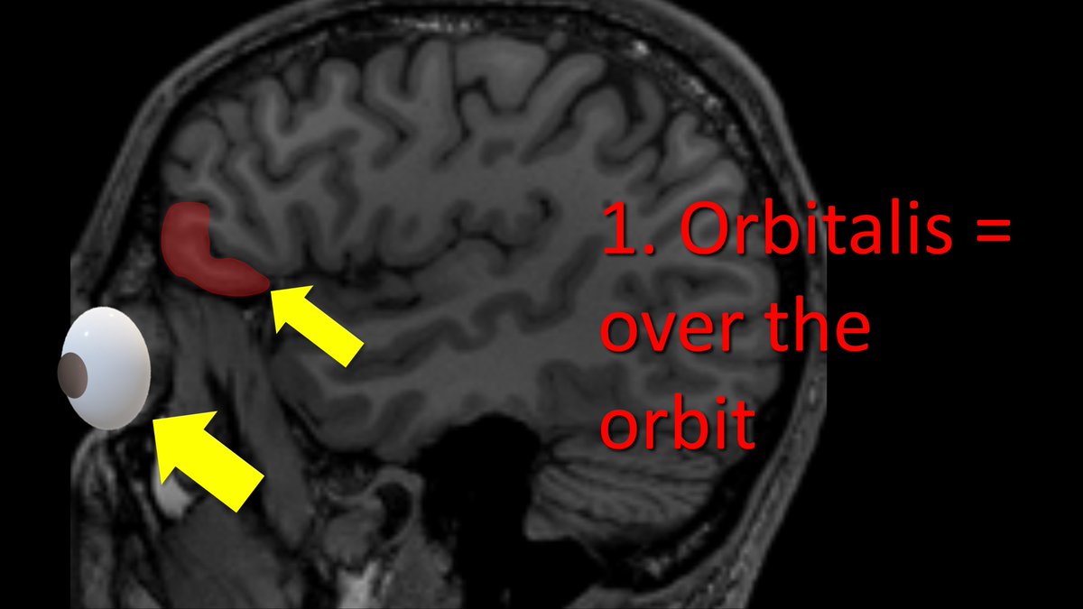 1/Do you get a Broca’s aphasia trying remember the location of Broca's ...