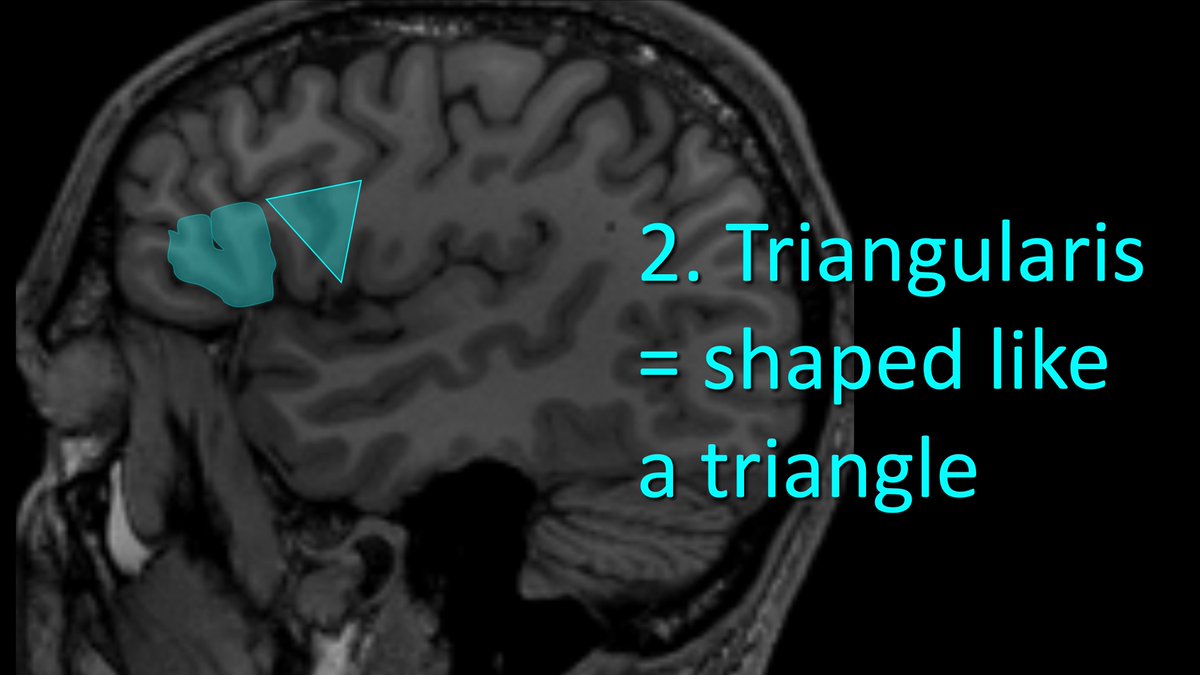 1/Do you get a Broca’s aphasia trying remember the location of Broca's ...